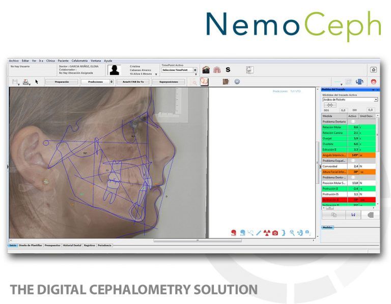 Nemotec Nemoceph - Clínica da Niza